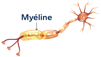 Sclérose en plaques | CHU de Québec-Université Laval